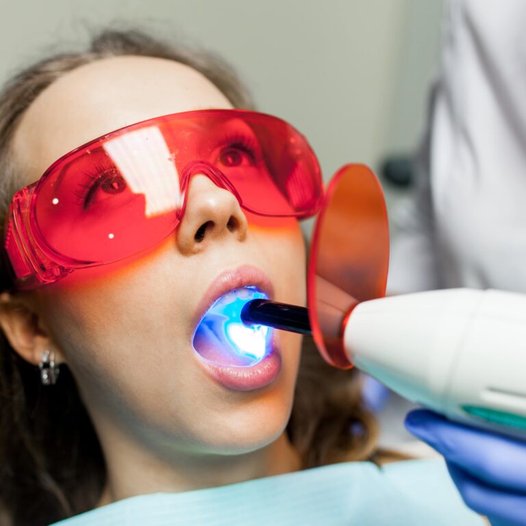 Teeth Bleaching in Bandra | 1 Stop Dental Clinic